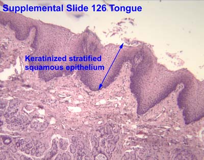 Stratified Squamous Nonkeratinized Epithelium Tongue